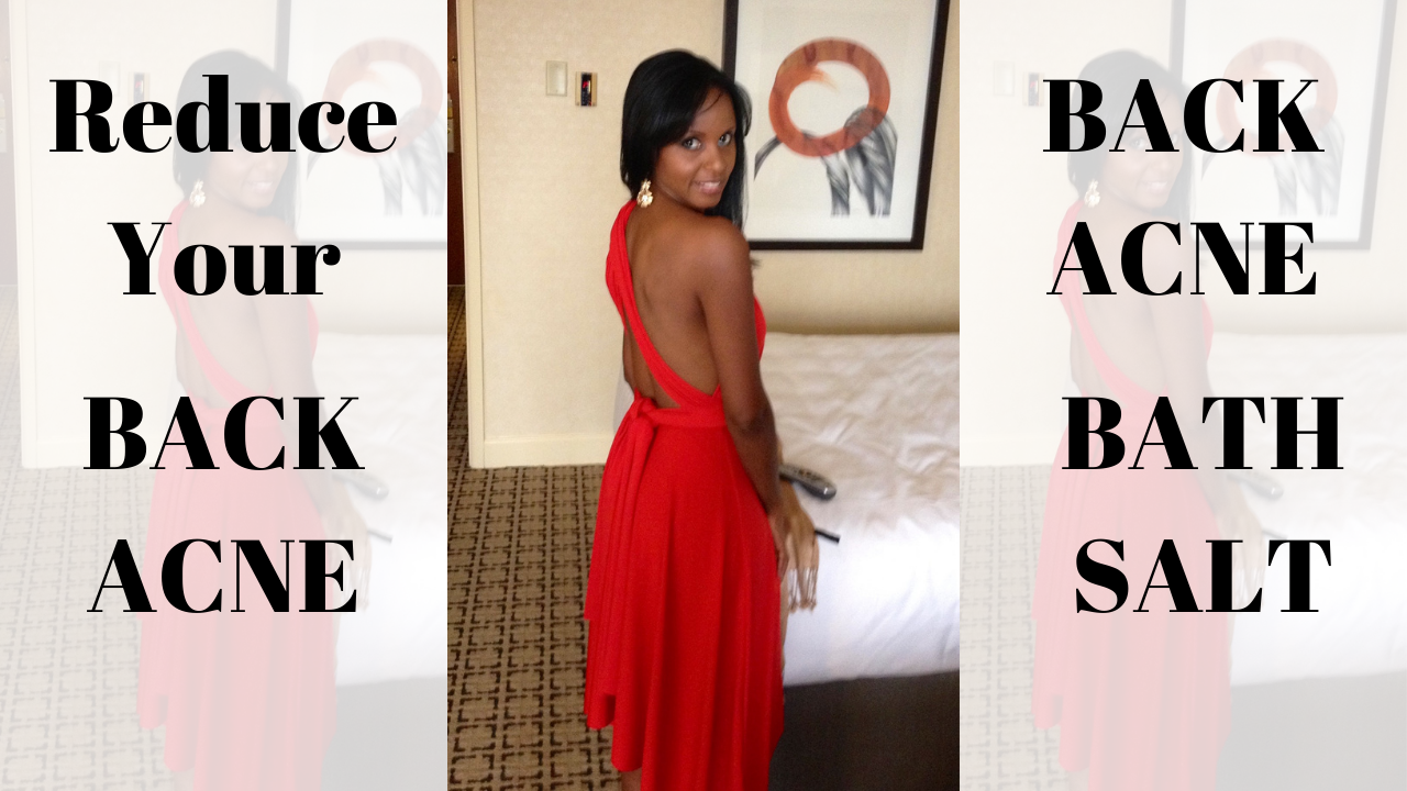 Back Acne Herbal Blend - Jovanka Ciares